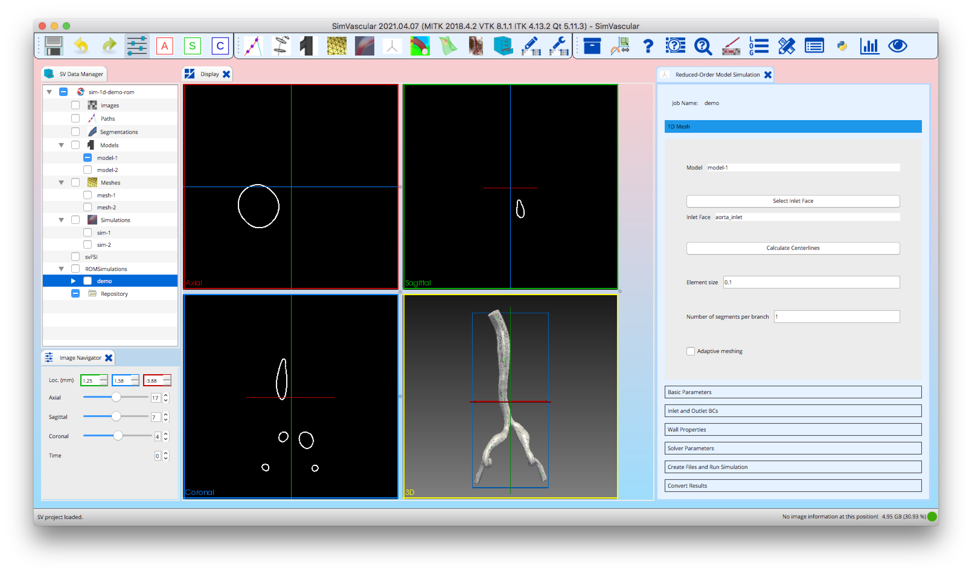 Add 0D modeling · Issue #815 · SimVascular/SimVascular · GitHub