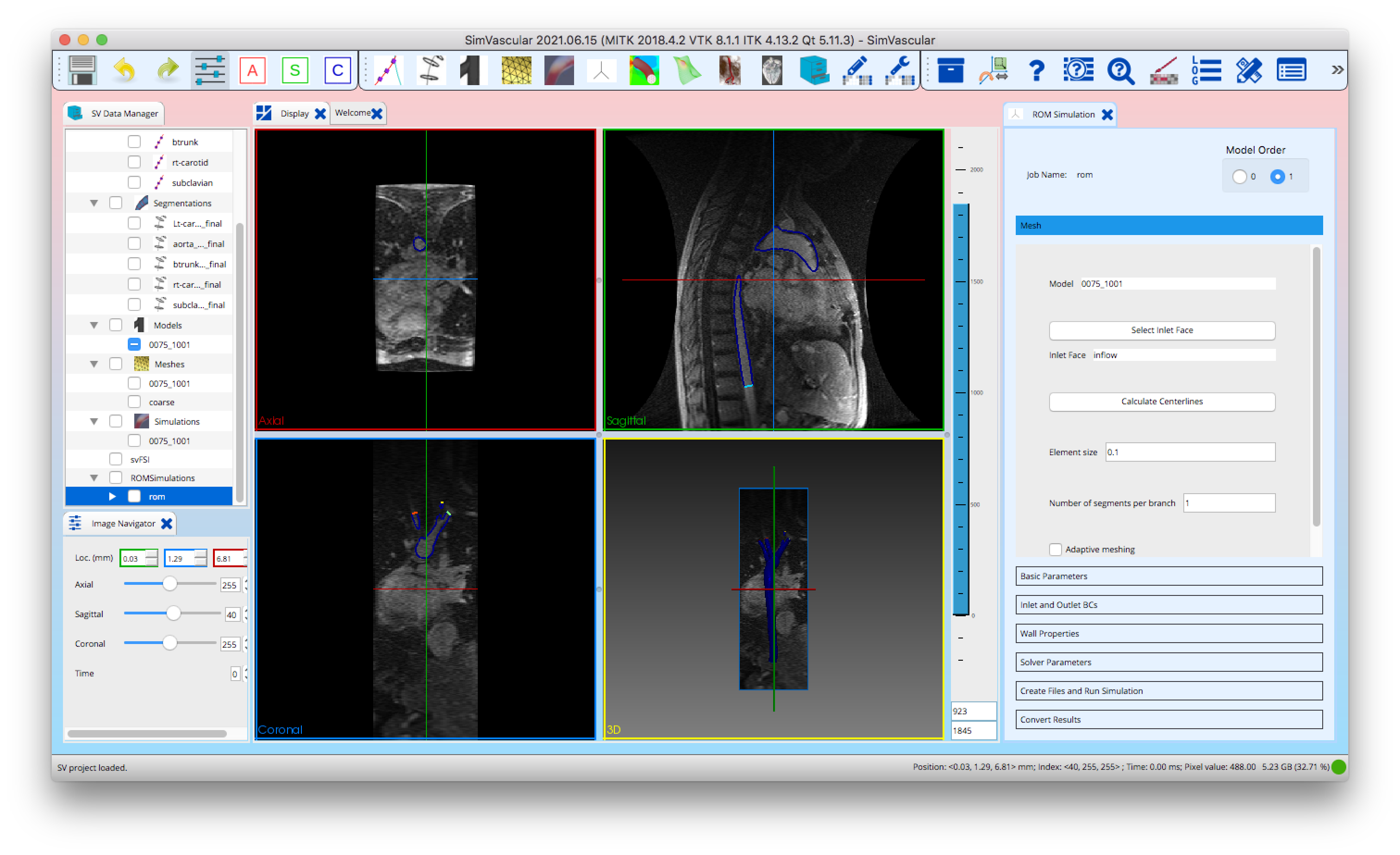 ROM: Only one mesh for result projection · Issue #910 · SimVascular/SimVascular · GitHub