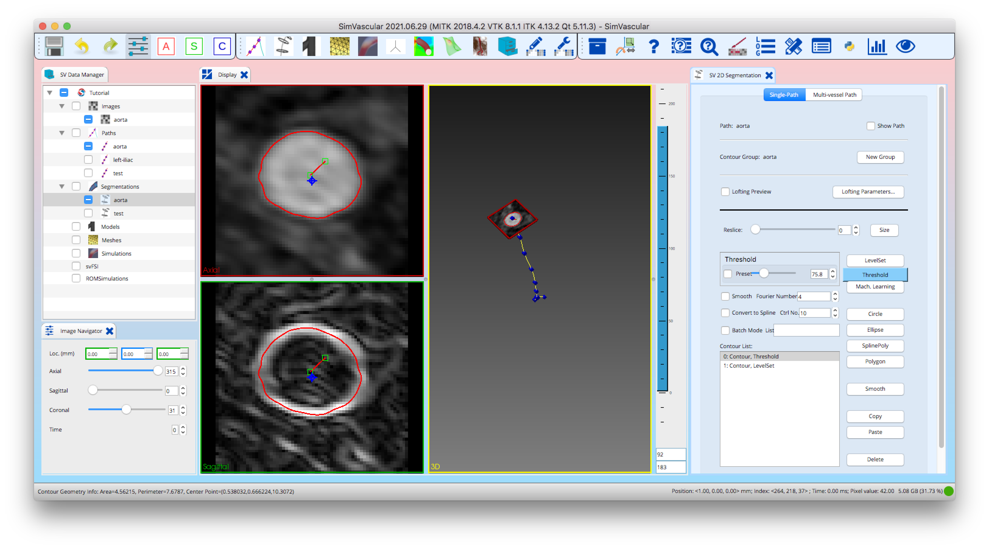 Segmentations Tool Image-based segmentation does not work correctly for ...