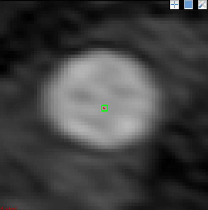 Machine learning segmentation does not create valid contours · Issue #982 · SimVascular ...