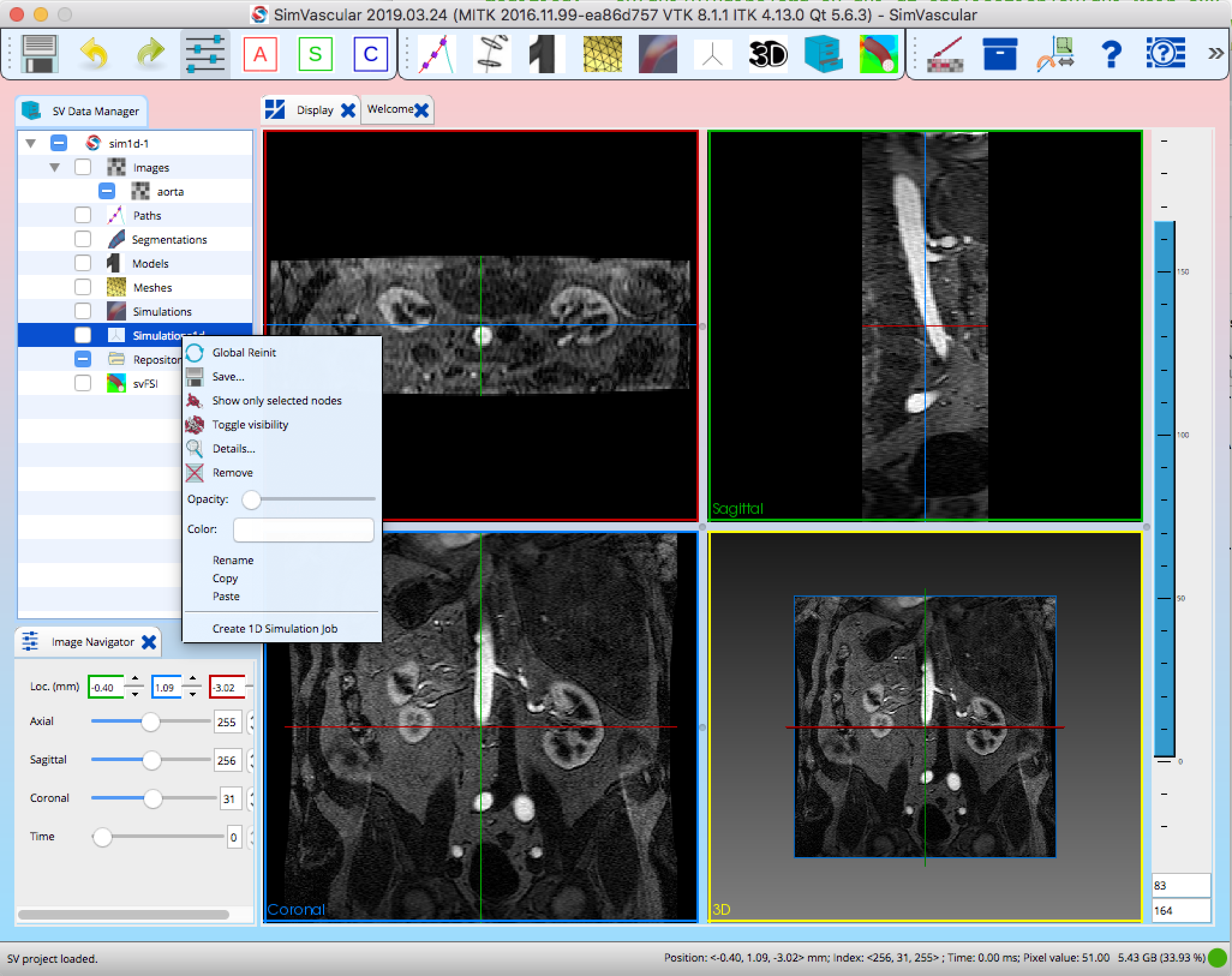 Create 1D Simulation Plugin · Issue #437 · SimVascular/SimVascular · GitHub