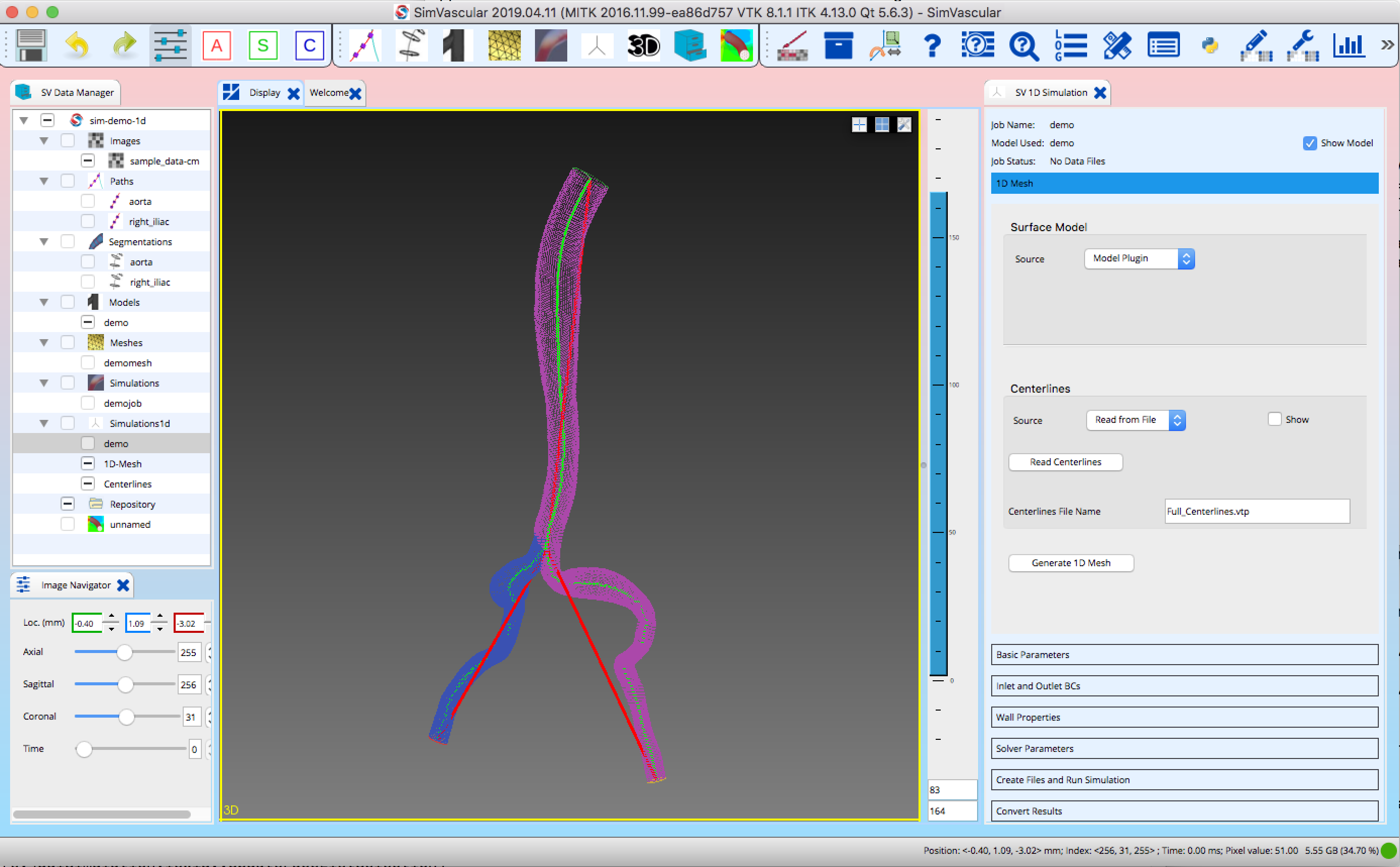 Create 1D Simulation Plugin · Issue #437 · SimVascular/SimVascular · GitHub