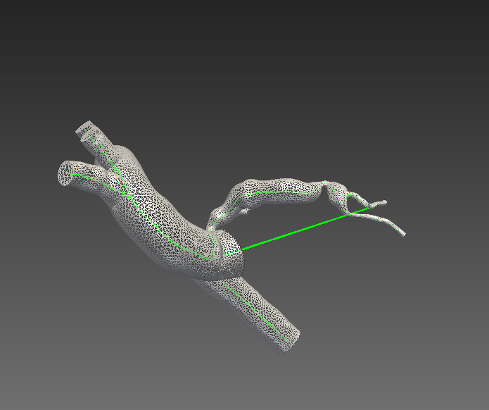 Create 1D Simulation Plugin · Issue #437 · SimVascular/SimVascular · GitHub