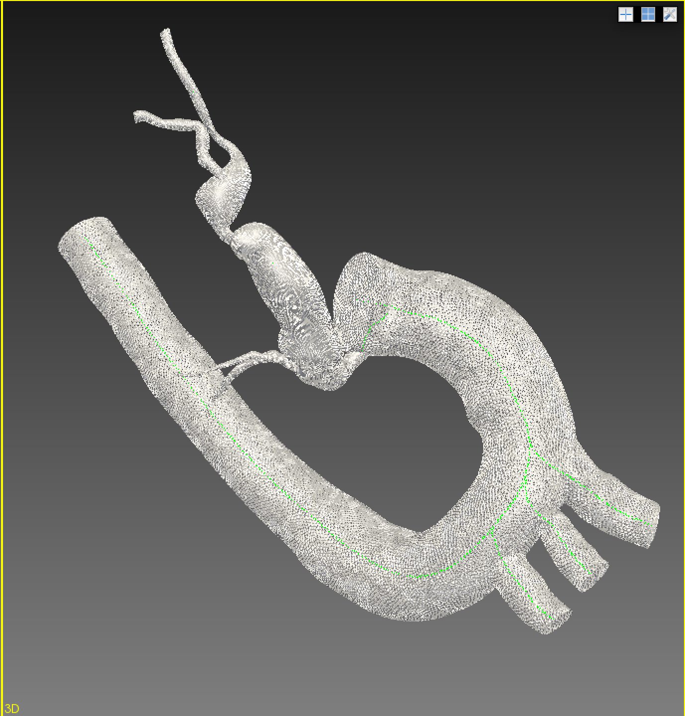 Create 1D Simulation Plugin · Issue #437 · SimVascular/SimVascular · GitHub
