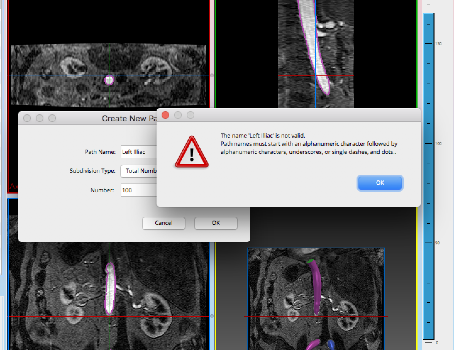 Setting Data Node names with non-alphanumberic characters is allowed · Issue #470 · SimVascular ...
