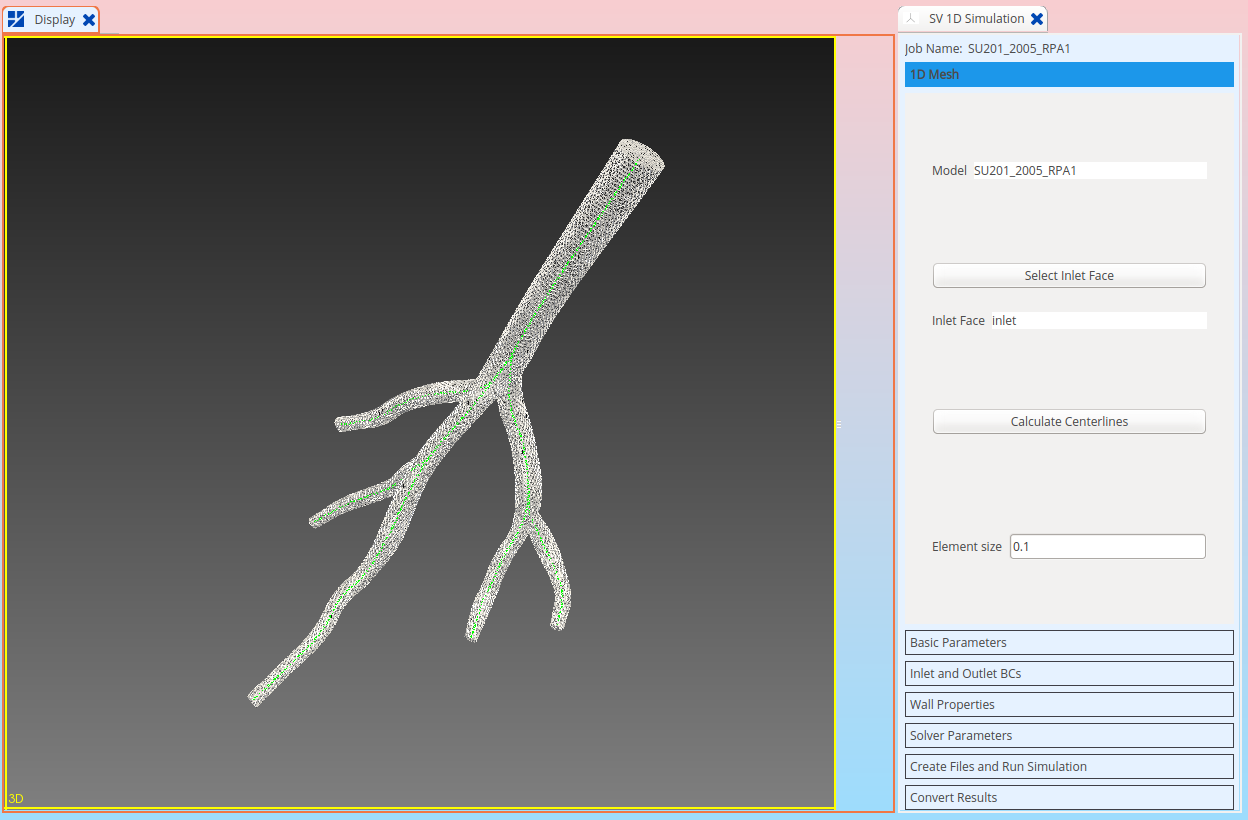 SV 1D Simulation "1D Mesh" gui frame doesn't resize · Issue #490 · SimVascular/SimVascular · GitHub