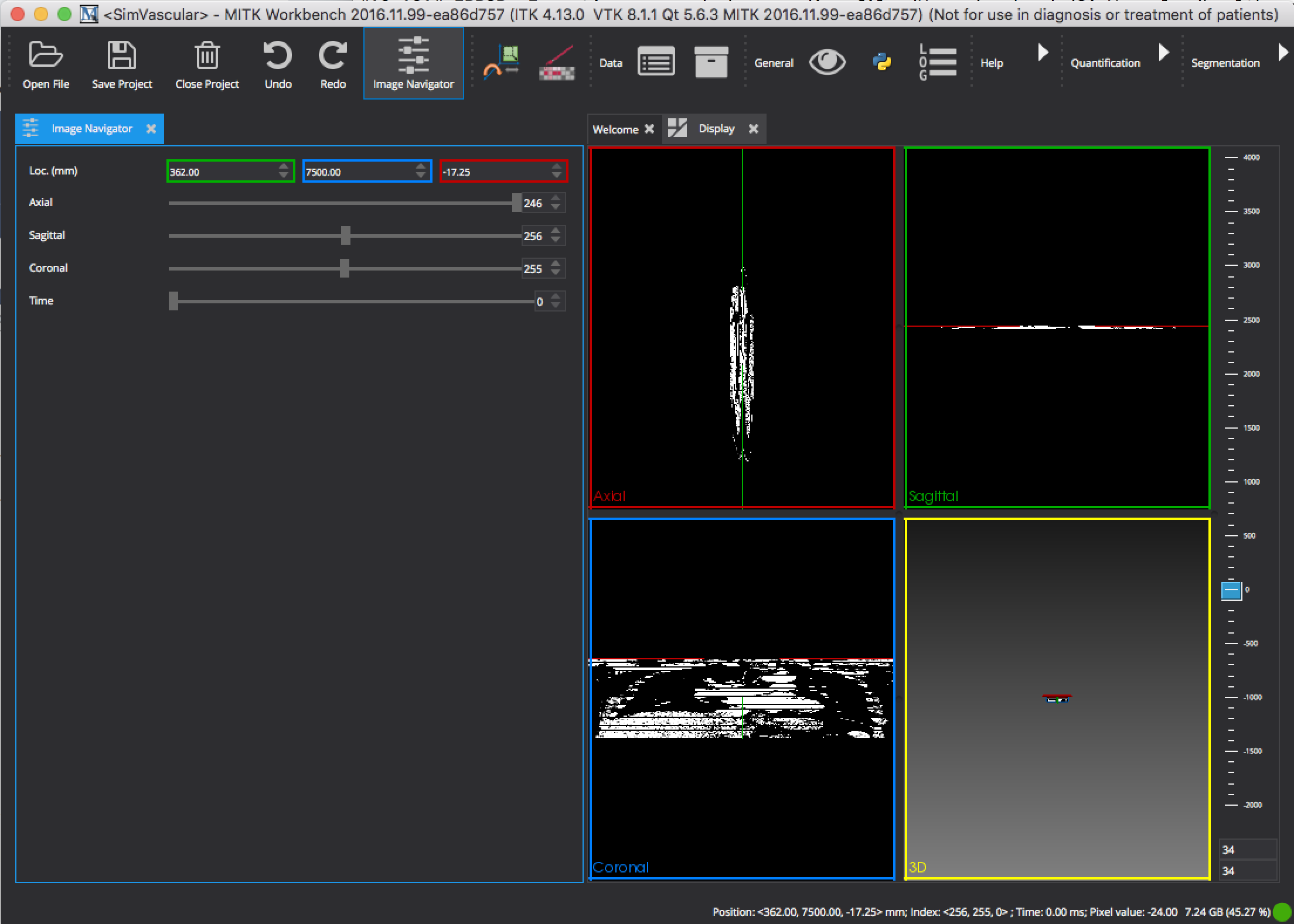 CT Modality DICOM images don't load correctly. · Issue #510 · SimVascular/SimVascular · GitHub
