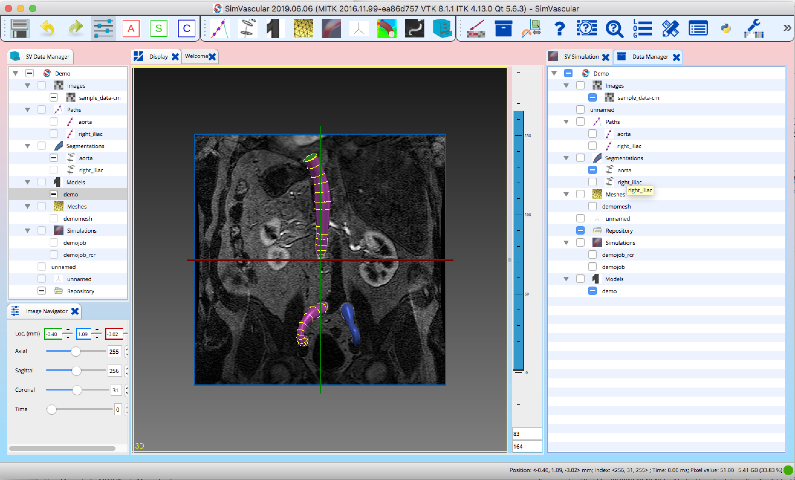 Selecting Data Node check box does not refresh graphics scene · Issue #515 · SimVascular ...