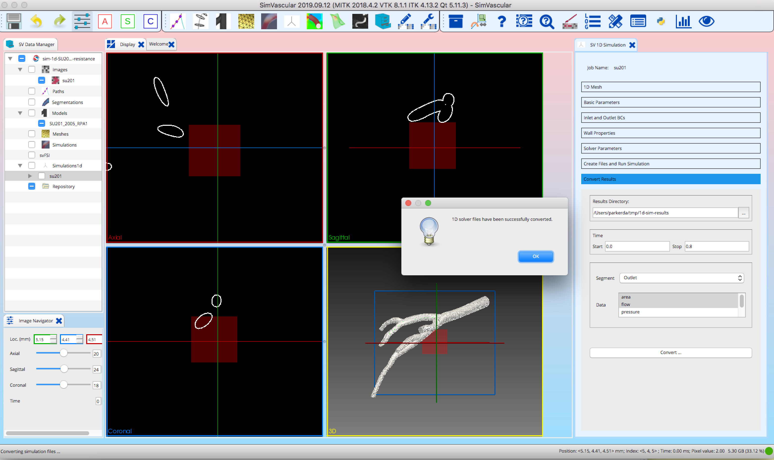 Add converting 1D solver simulation results · Issue #583 · SimVascular/SimVascular · GitHub