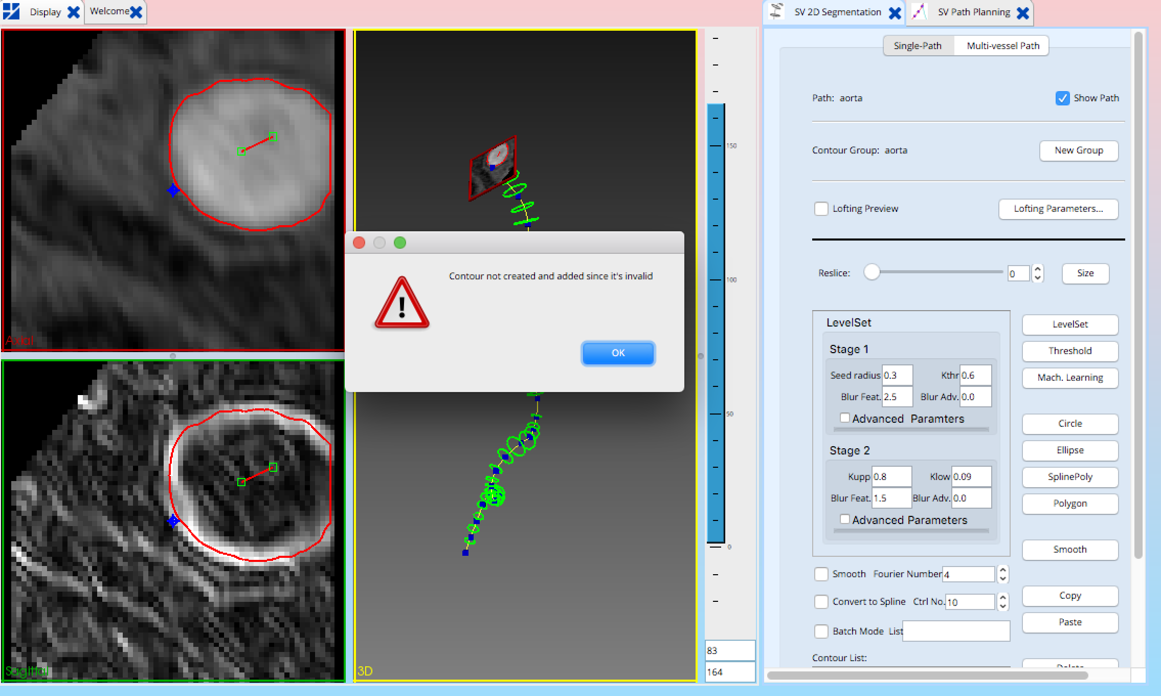 Improve segmentation failure message · Issue #613 · SimVascular/SimVascular · GitHub