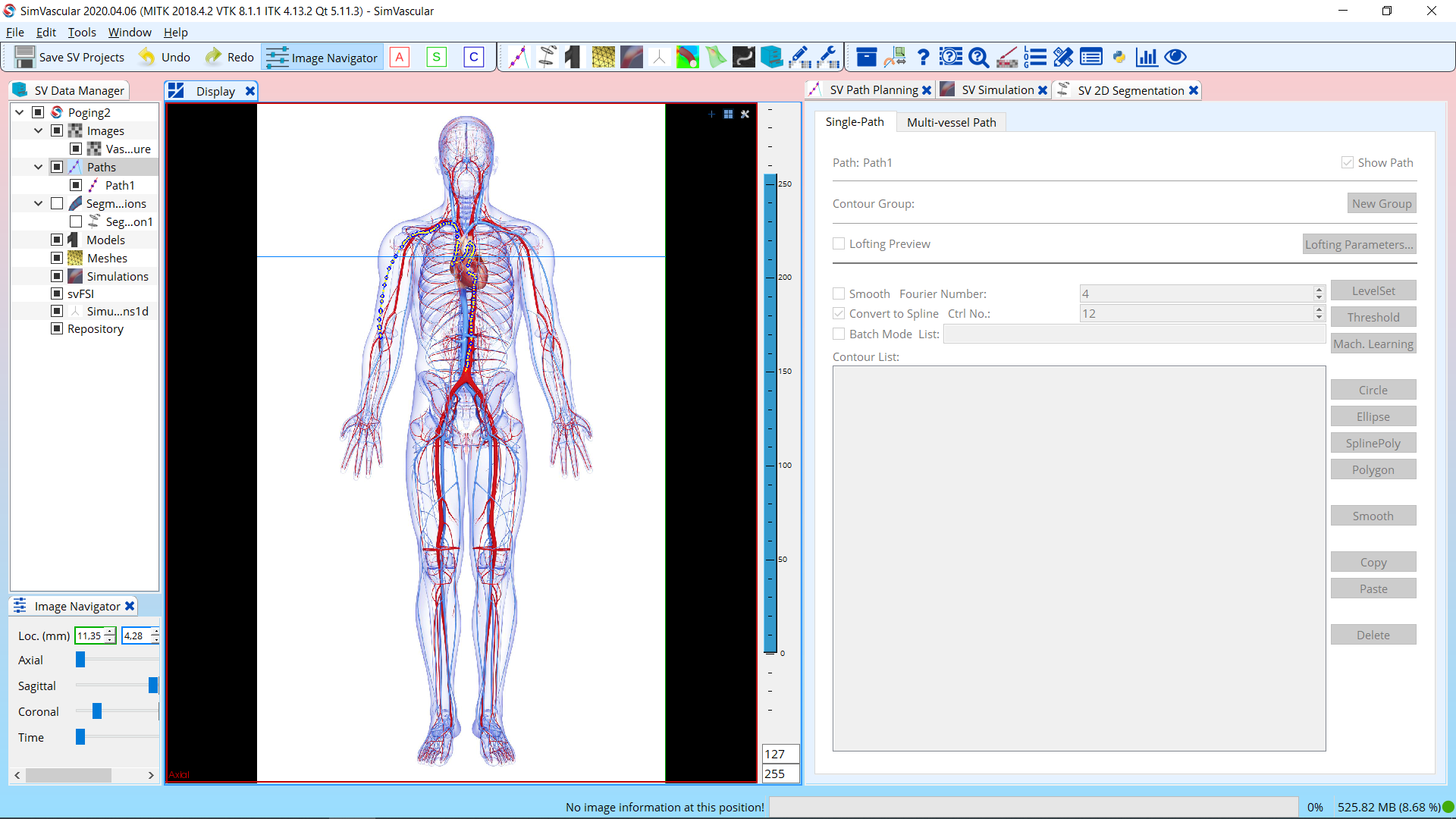 There is no check for valid 3D image data · Issue #670 · SimVascular/SimVascular · GitHub