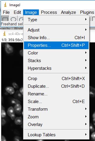 Automatic Quantification Issue · Issue #163 · qupath/qupath · GitHub
