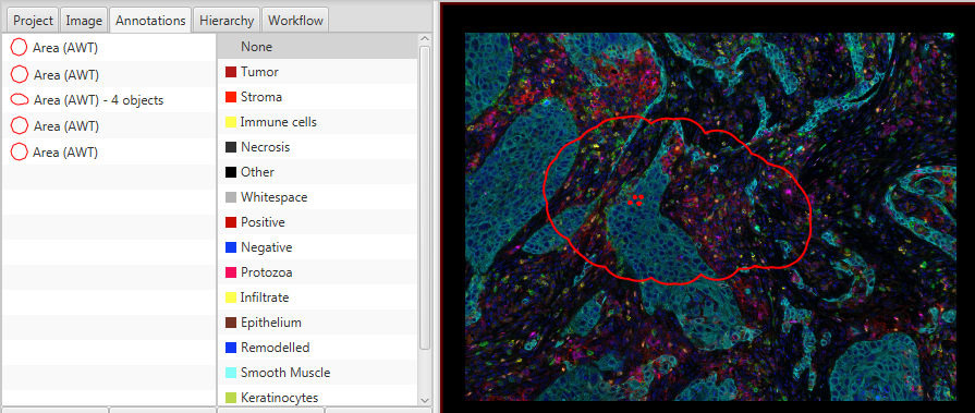 convert annotations into detections. Counting in the annotations TAB is wrong · Issue #259 ...