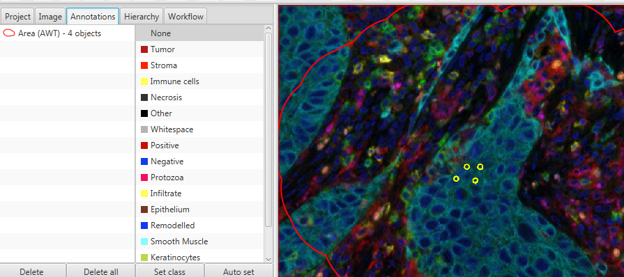 convert annotations into detections. Counting in the annotations TAB is wrong · Issue #259 ...