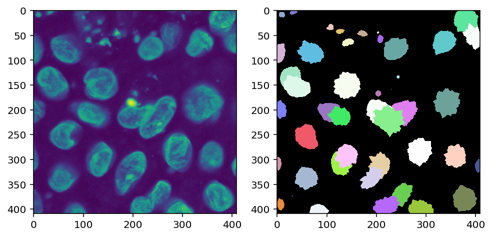 Is there a way to make model.predict_instances run on the gpu? · Issue #32 · stardist/stardist ...