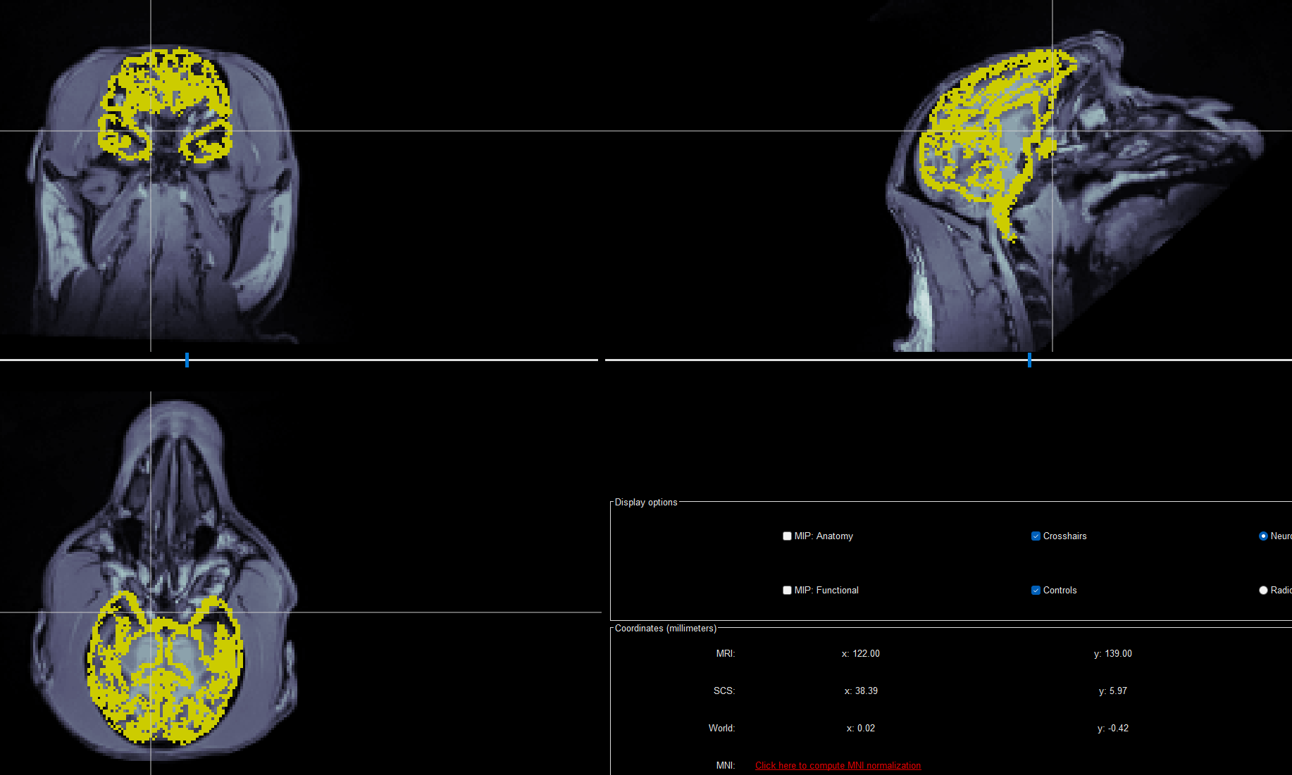 E-phys: Integrate plugin manager and fix code online tutorials · Issue #387 · brainstorm-tools ...