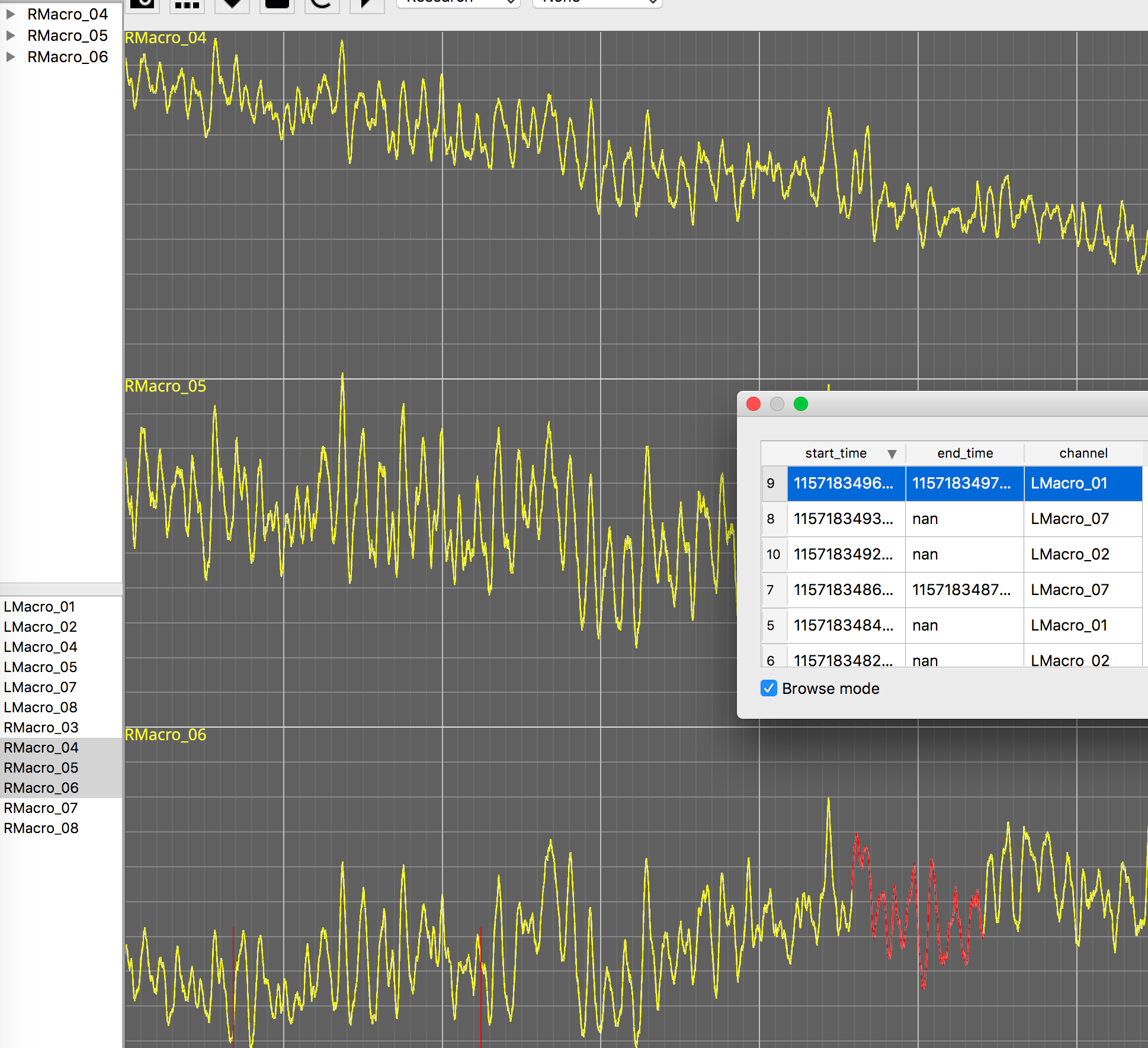 bug - Annotations - channels specific annotations not working properly · Issue #6 · ICRC-BME ...