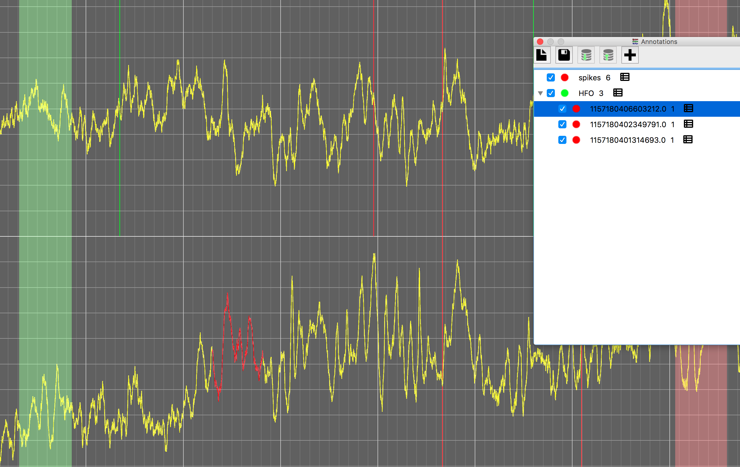 bug - adding annotations when annotation subset is active in annotation widget · Issue #9 · ICRC ...