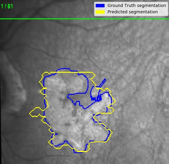 GitHub - israelwei/AMD_project: Automatic classification and ...