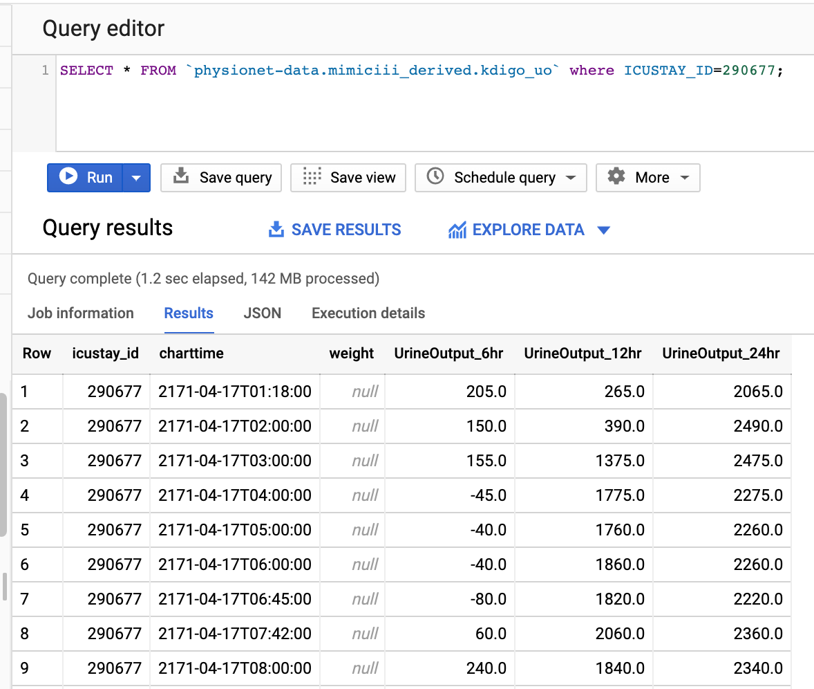 Negative urine-ouput values in AKI scoring queries · Issue #745 · MIT-LCP/mimic-code · GitHub