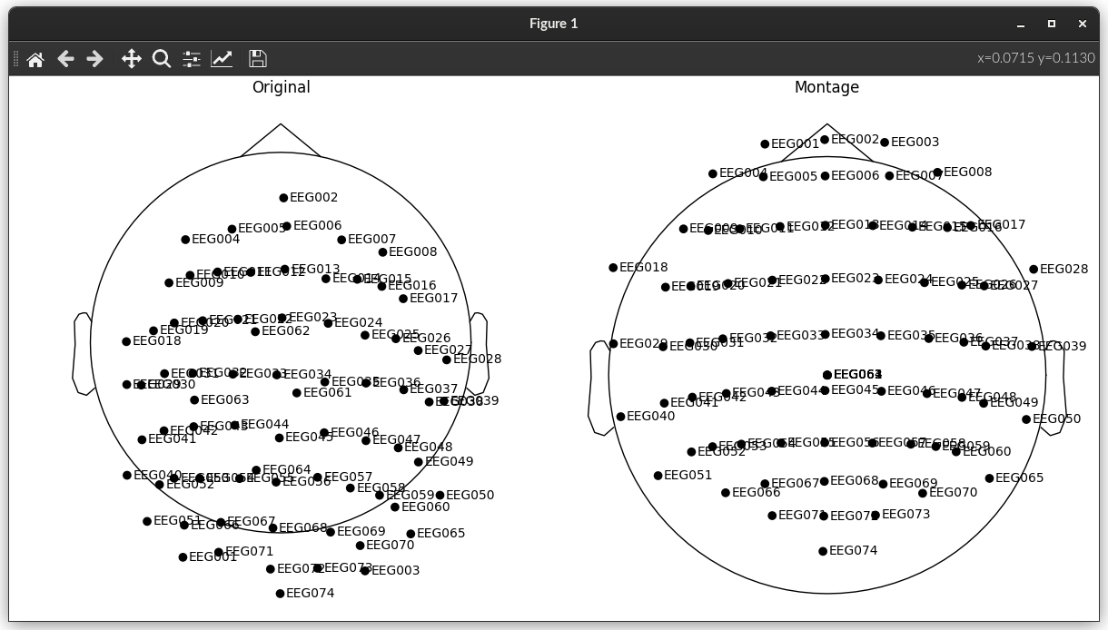 Bug Mgh60 Montage Is Incorrect For Sample · Issue 11285 · Mne Toolsmne Python · Github 