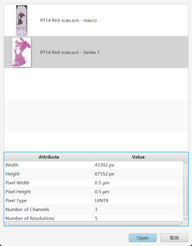 SCN file open only in low magnification · Issue #278 · qupath/qupath · GitHub