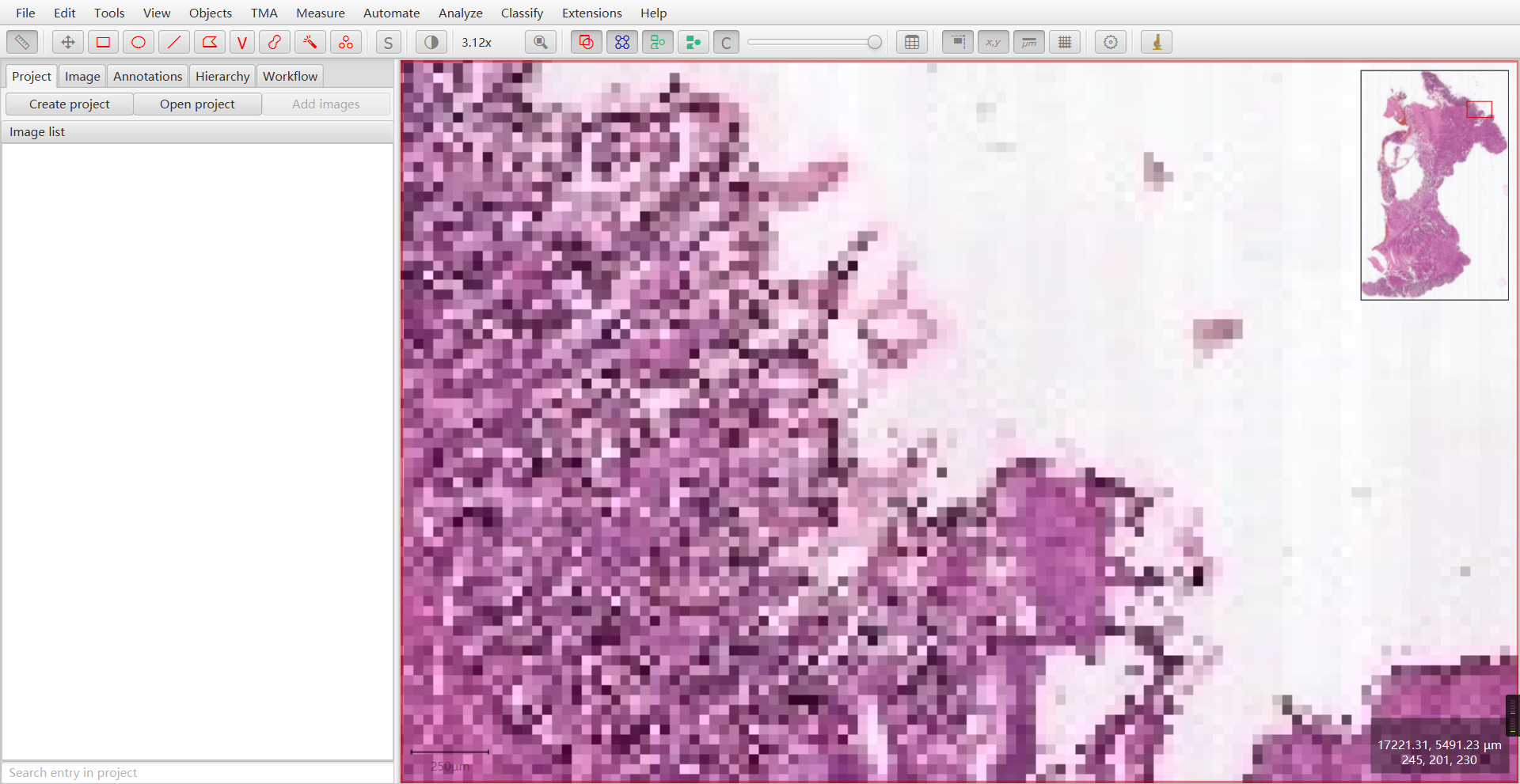 SCN file open only in low magnification · Issue #278 · qupath/qupath · GitHub