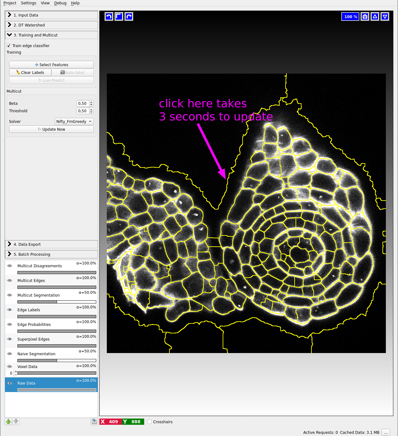 Multicut: not all edges can be clicked · Issue #2476 · ilastik/ilastik ...