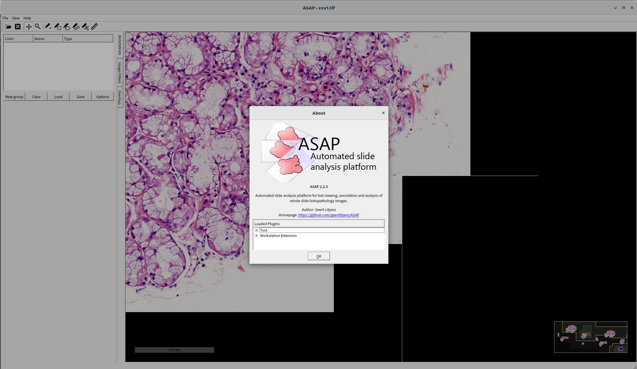 ASAP-2.2 has problems displaying tifs · Issue #264 ...