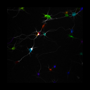 Neurons segmentation · Issue #21 · MouseLand/cellpose · GitHub