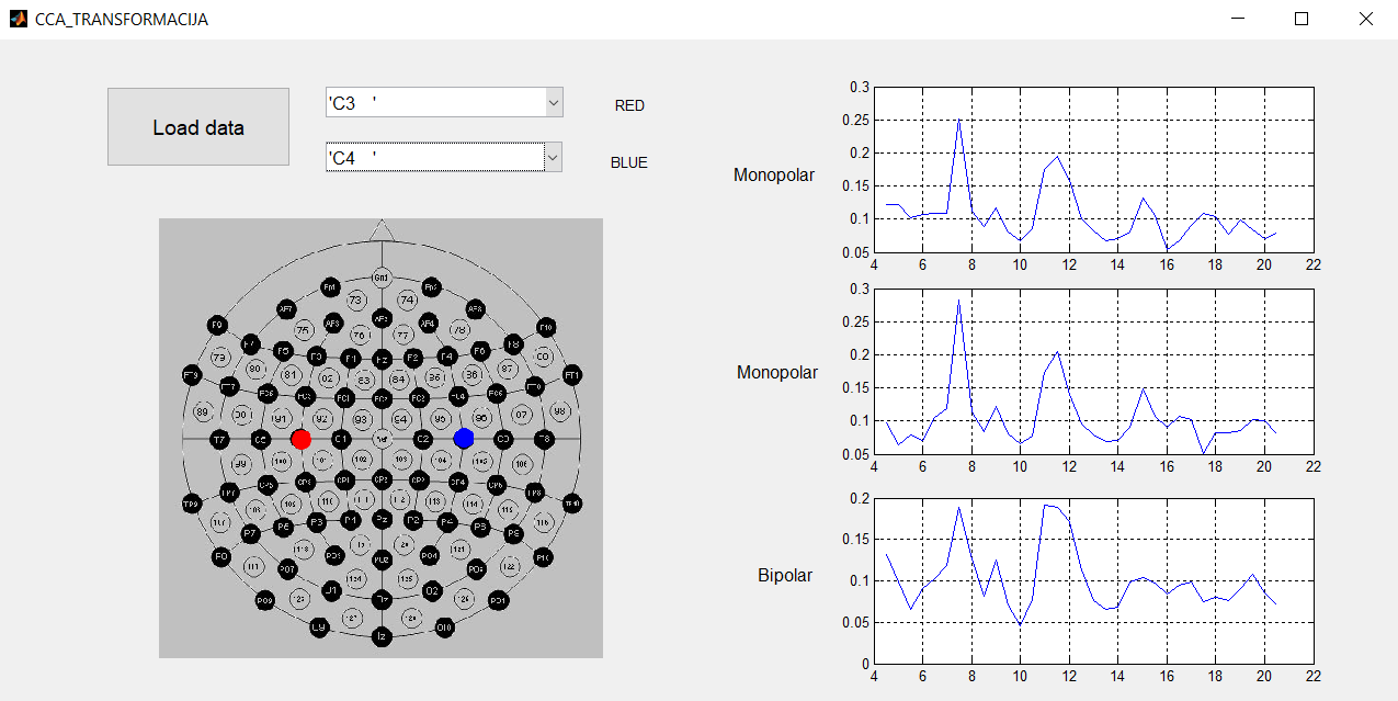 GitHub - Dajana9/EEG---SSVEP