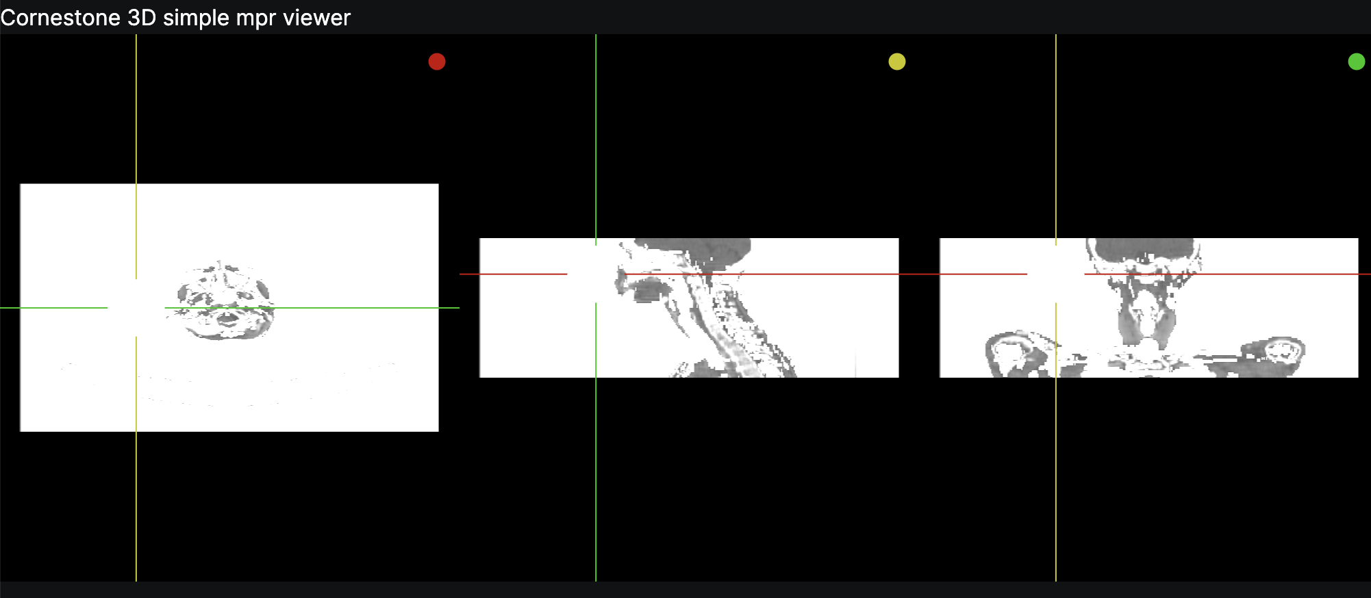 Inverted contrast in some CT studies using MPR, Crosshairs, Volume loader viewer configuration ...