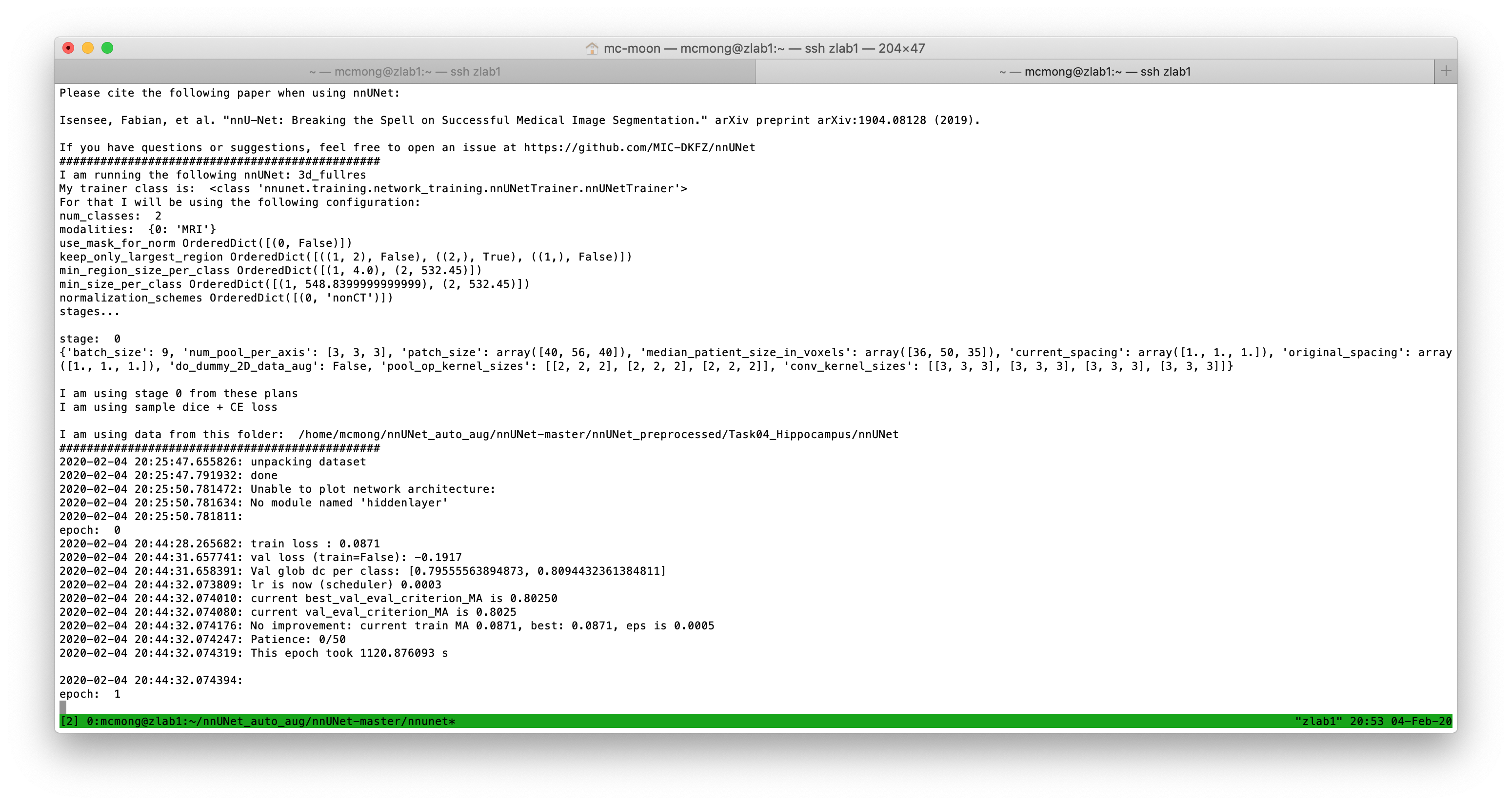 The training process is frozen when implement MultiThreadedAugmenter · Issue #145 · MIC-DKFZ ...