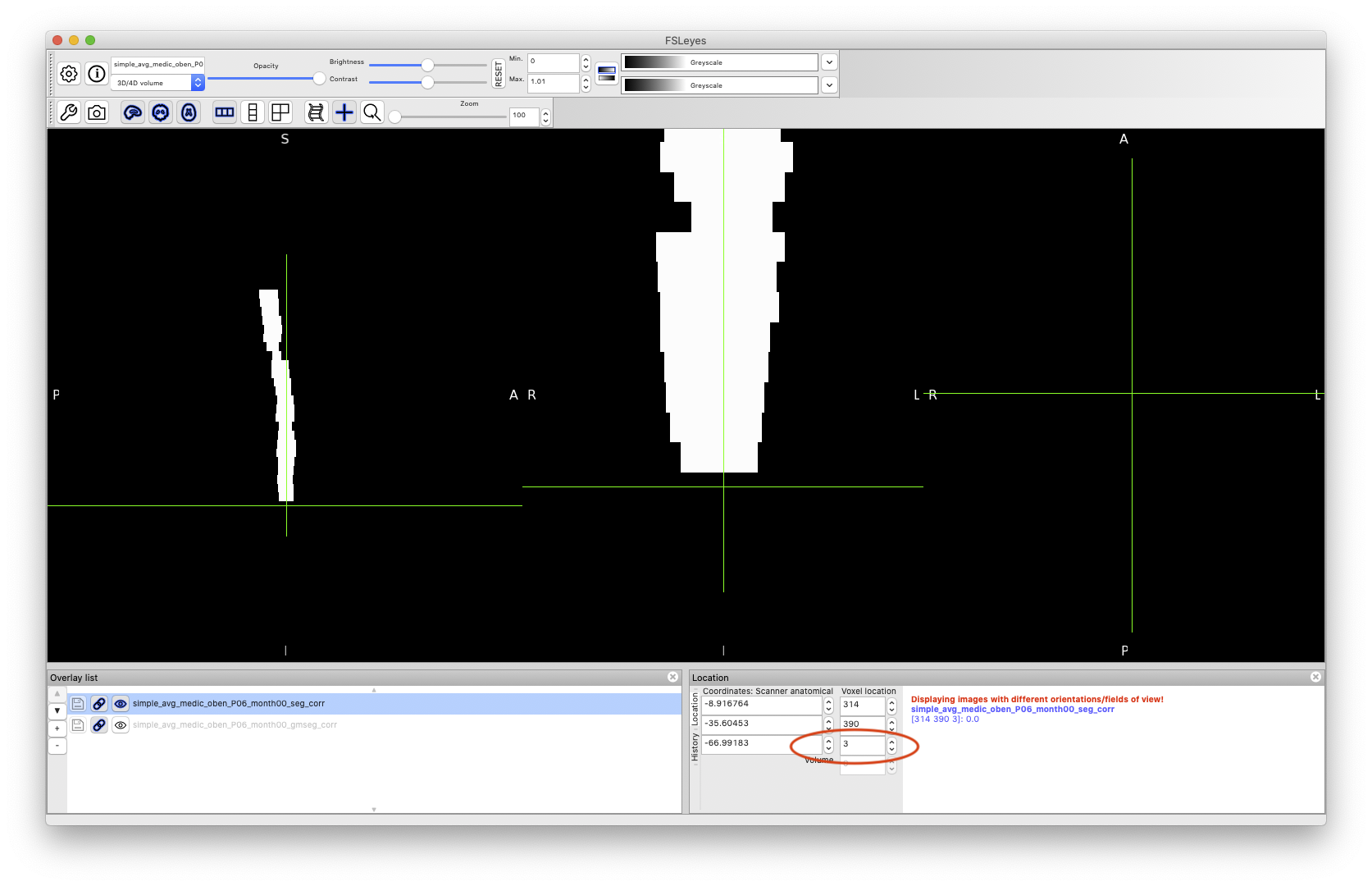 Morphometric Values Are Reported In Slices That Are Not Segmented · Issue 3402 