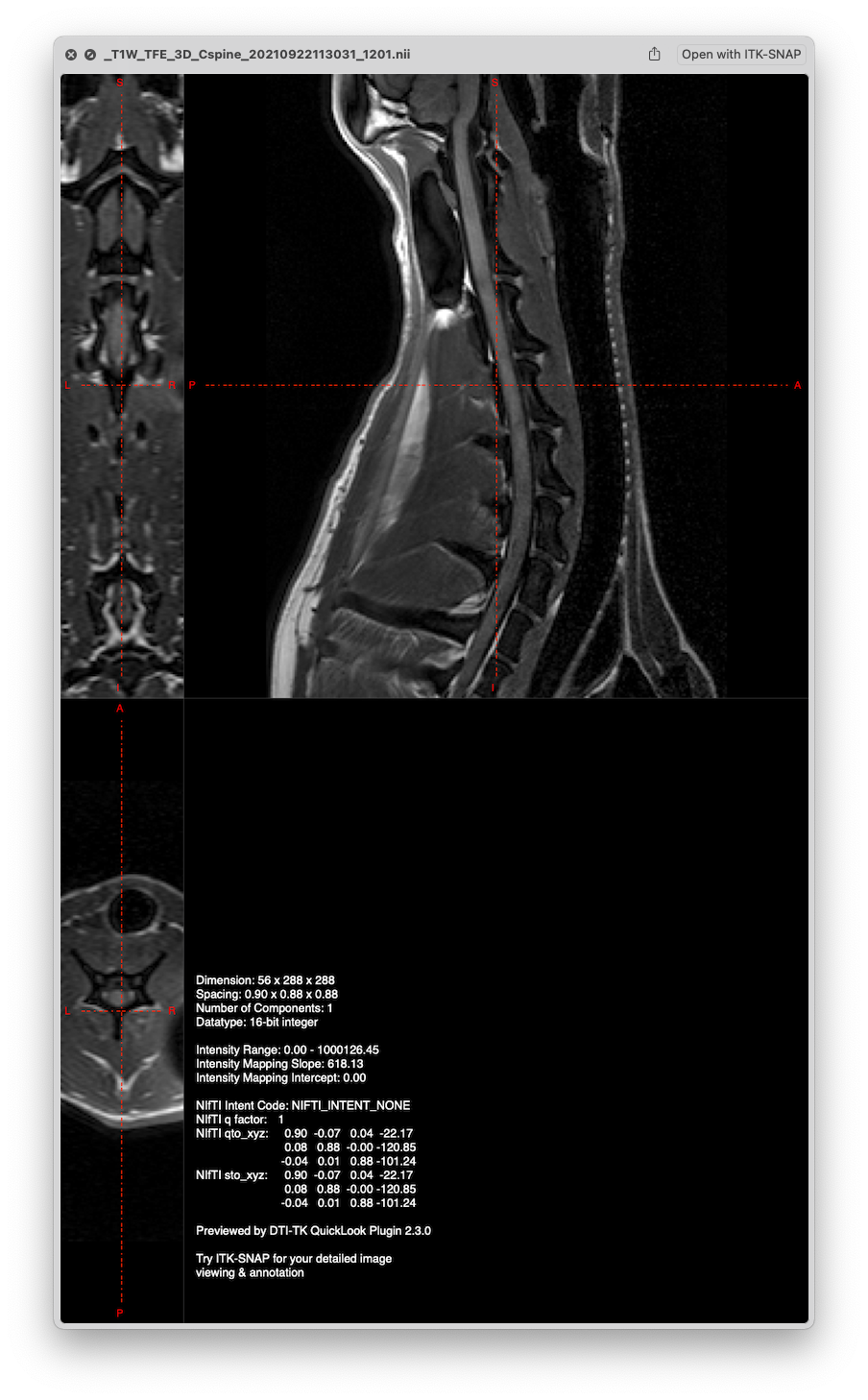 Data stitching · Issue #1 · spinalcordtoolbox/template-dog · GitHub