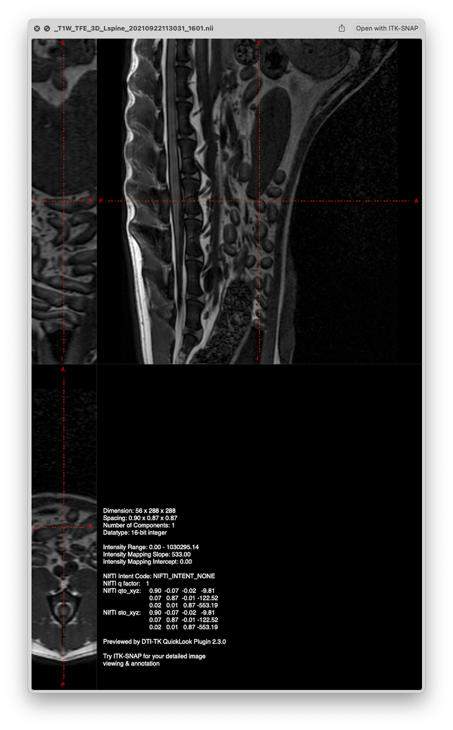 Data stitching · Issue #1 · spinalcordtoolbox/template-dog · GitHub