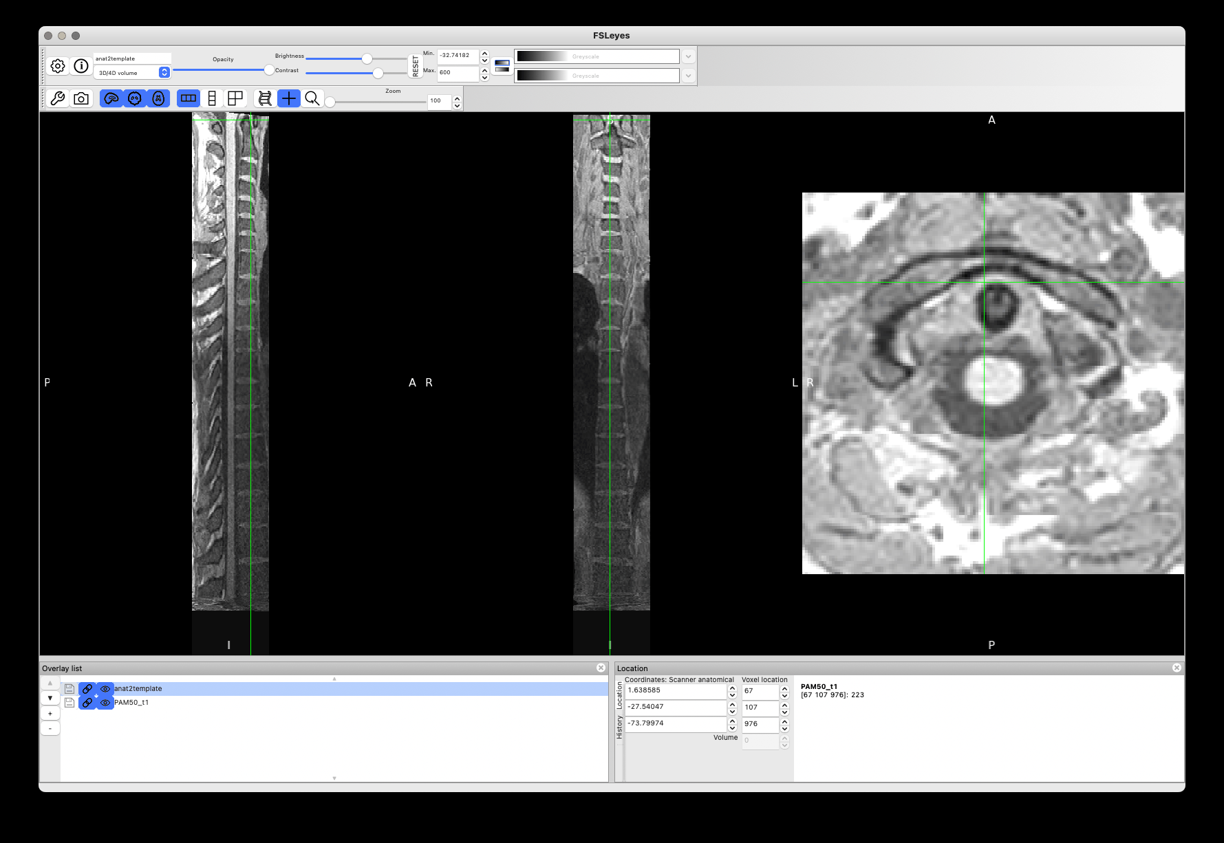 Registration using 3+ disc labels results in distorted top portion of warped template · Issue ...