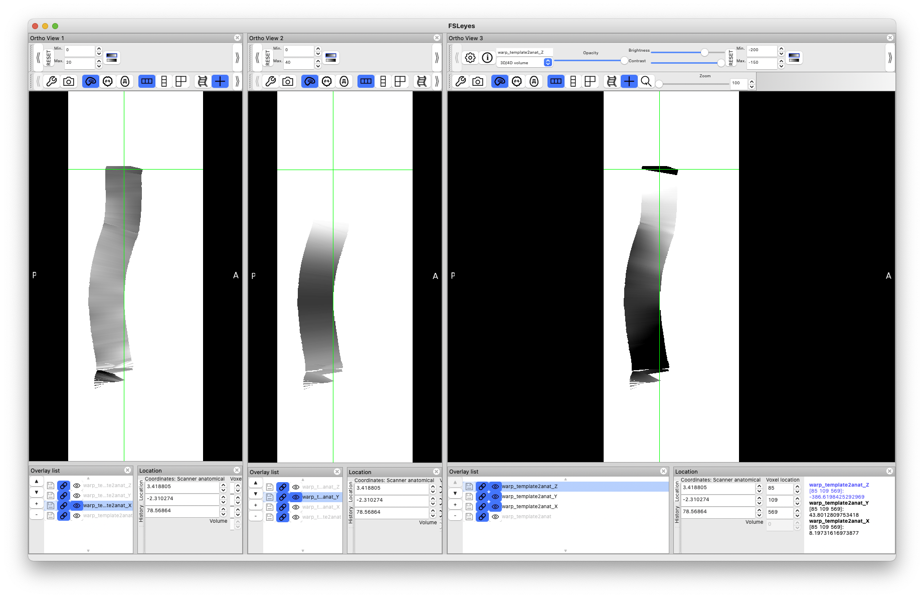 Registration using 3+ disc labels results in distorted top portion of warped template · Issue ...