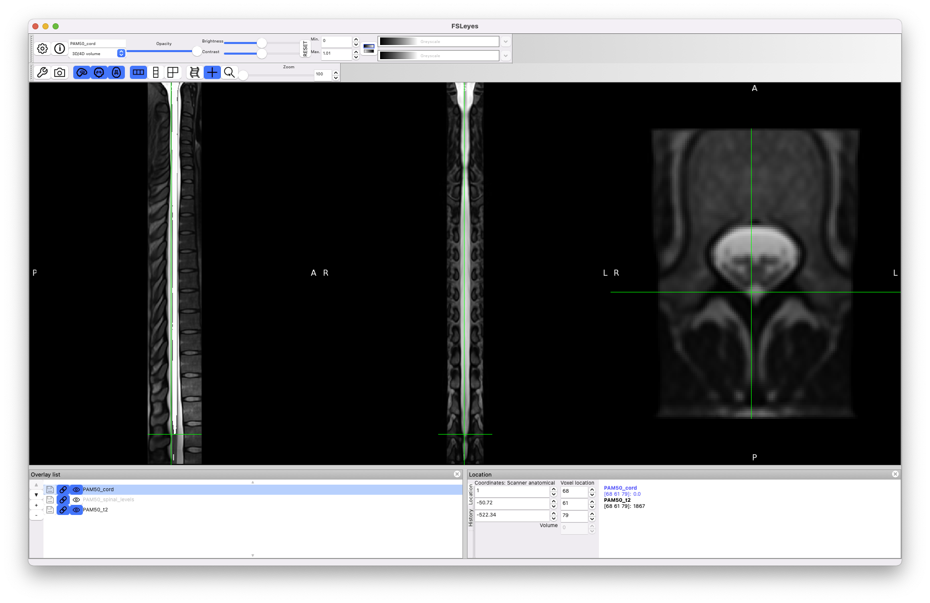 The spinal cord in `PAM50_cord.nii.gz` is missing the caudal part · Issue #19 ...