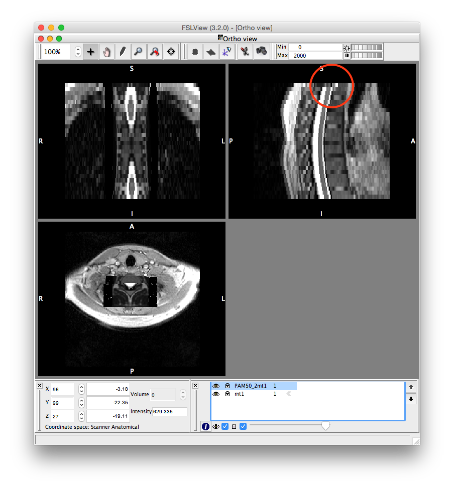 Edge effect on warping field · Issue #1360 · spinalcordtoolbox/spinalcordtoolbox · GitHub