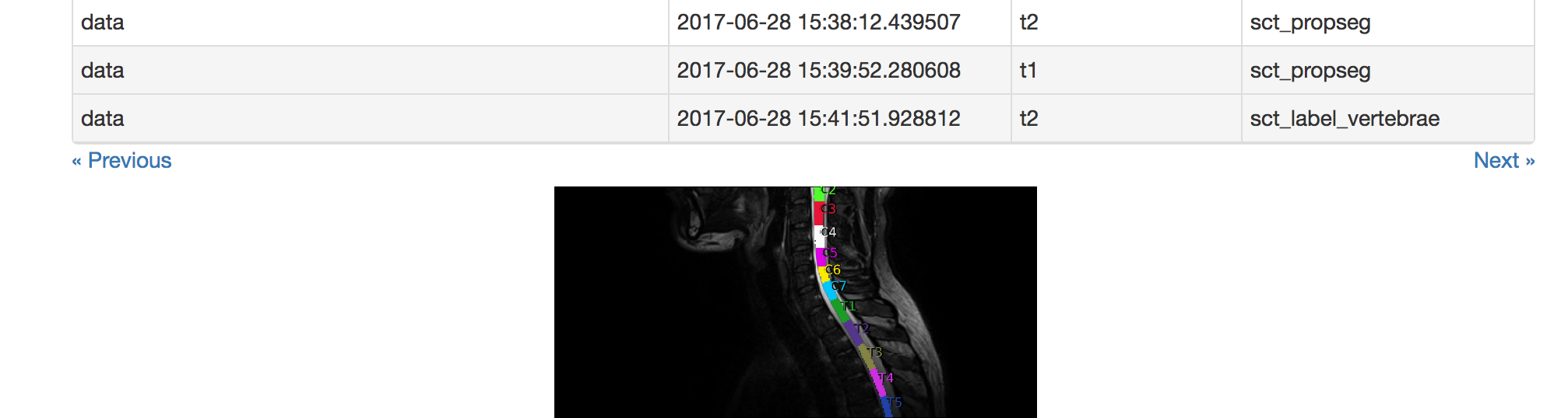 various improvements on QC · Issue #1271 · spinalcordtoolbox/spinalcordtoolbox · GitHub