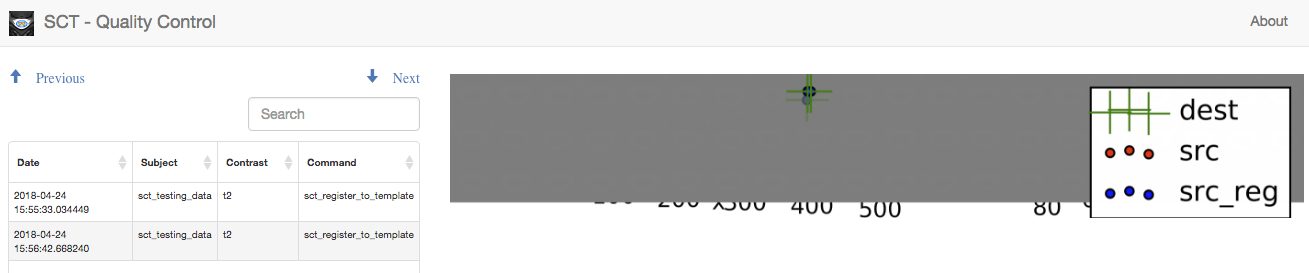 Legacy image appears on QC · Issue #1695 · spinalcordtoolbox/spinalcordtoolbox · GitHub