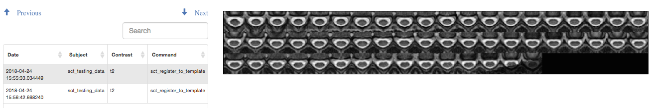 Legacy image appears on QC · Issue #1695 · spinalcordtoolbox ...