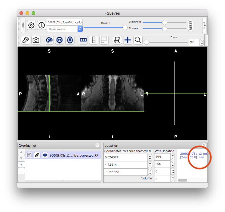 sct_deepseg_sc empty result on data after motion correction · Issue #1770 · spinalcordtoolbox ...