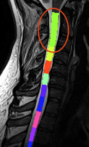 Change colormap for fsleyes syntax · Issue #1810 · spinalcordtoolbox ...