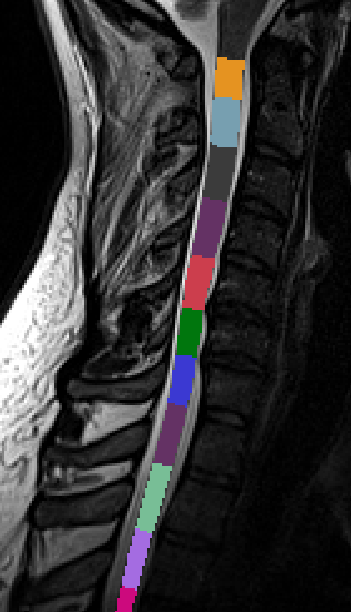 Change colormap for fsleyes syntax · Issue #1810 · spinalcordtoolbox ...