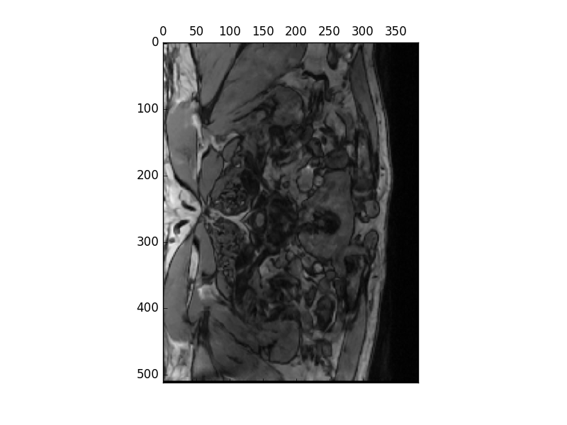 Likely some NIFTI header problem when using the viewer for initialize ...
