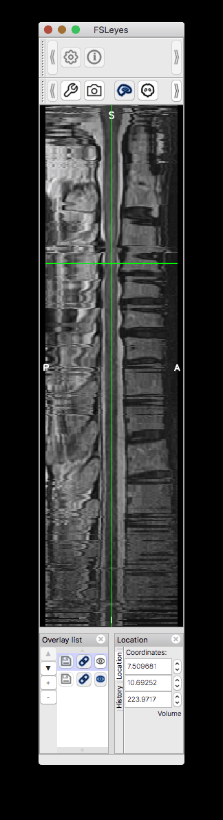 Straightening glitches · Issue #2210 · spinalcordtoolbox/spinalcordtoolbox · GitHub