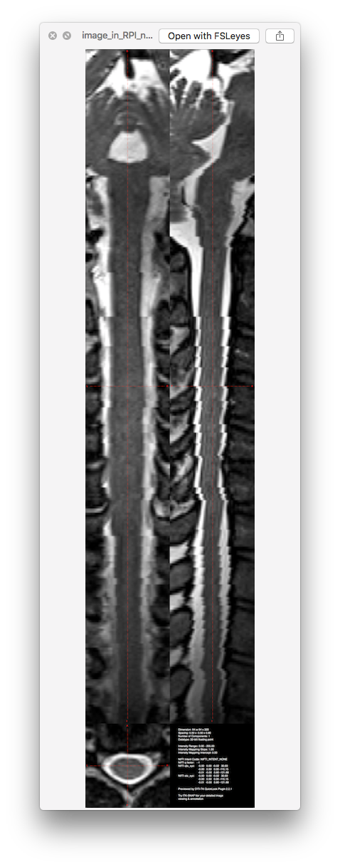 Weird looking straightened spinal cord as input to deepseg algo · Issue #2234 ...