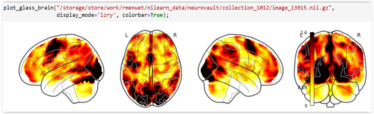 plot_glass_brain with 4 cuts displays the colorbar on the 4th view ...